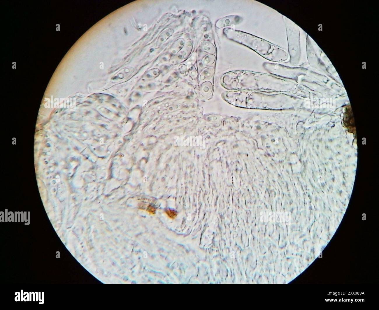 Operculate Ascomycetes (Pezizomycetes) Fungi Stock Photo - Alamy