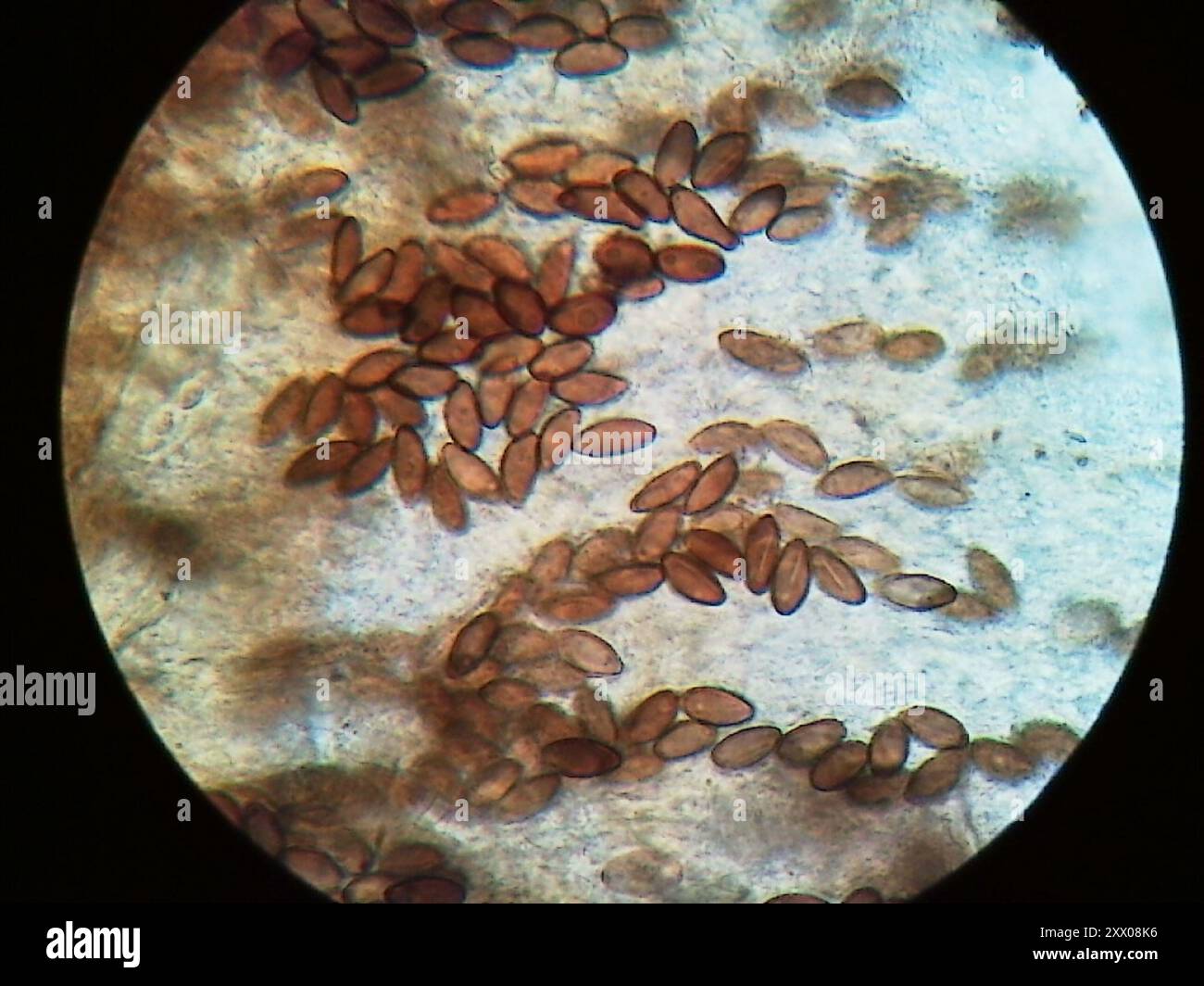 (Rosellinia subiculata) Fungi Stock Photo - Alamy