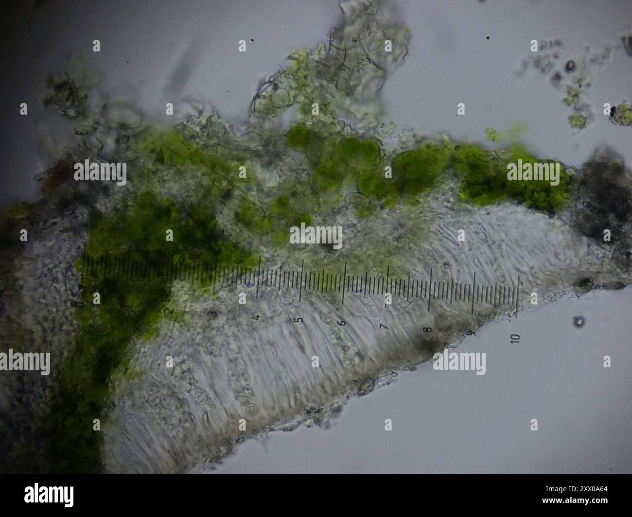 (Myriolecis sambuci) Fungi Stock Photo - Alamy