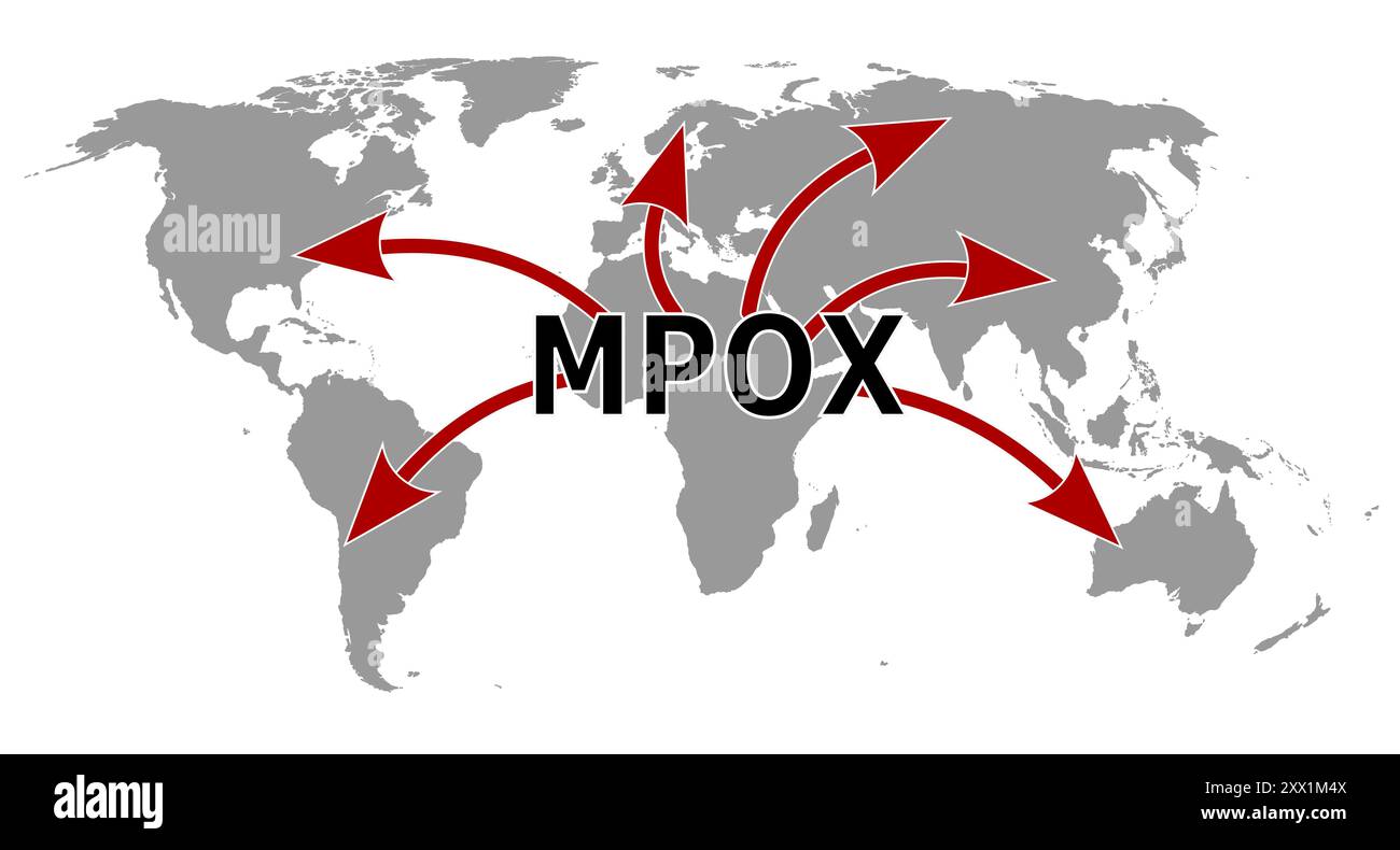 Vector Illustration Of Mpox Diseases Spreading From Africa To Whole