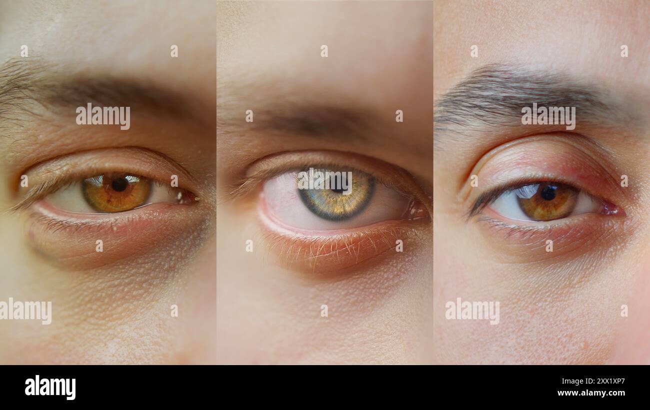 Different eye colors human hi-res stock photography and images - Alamy