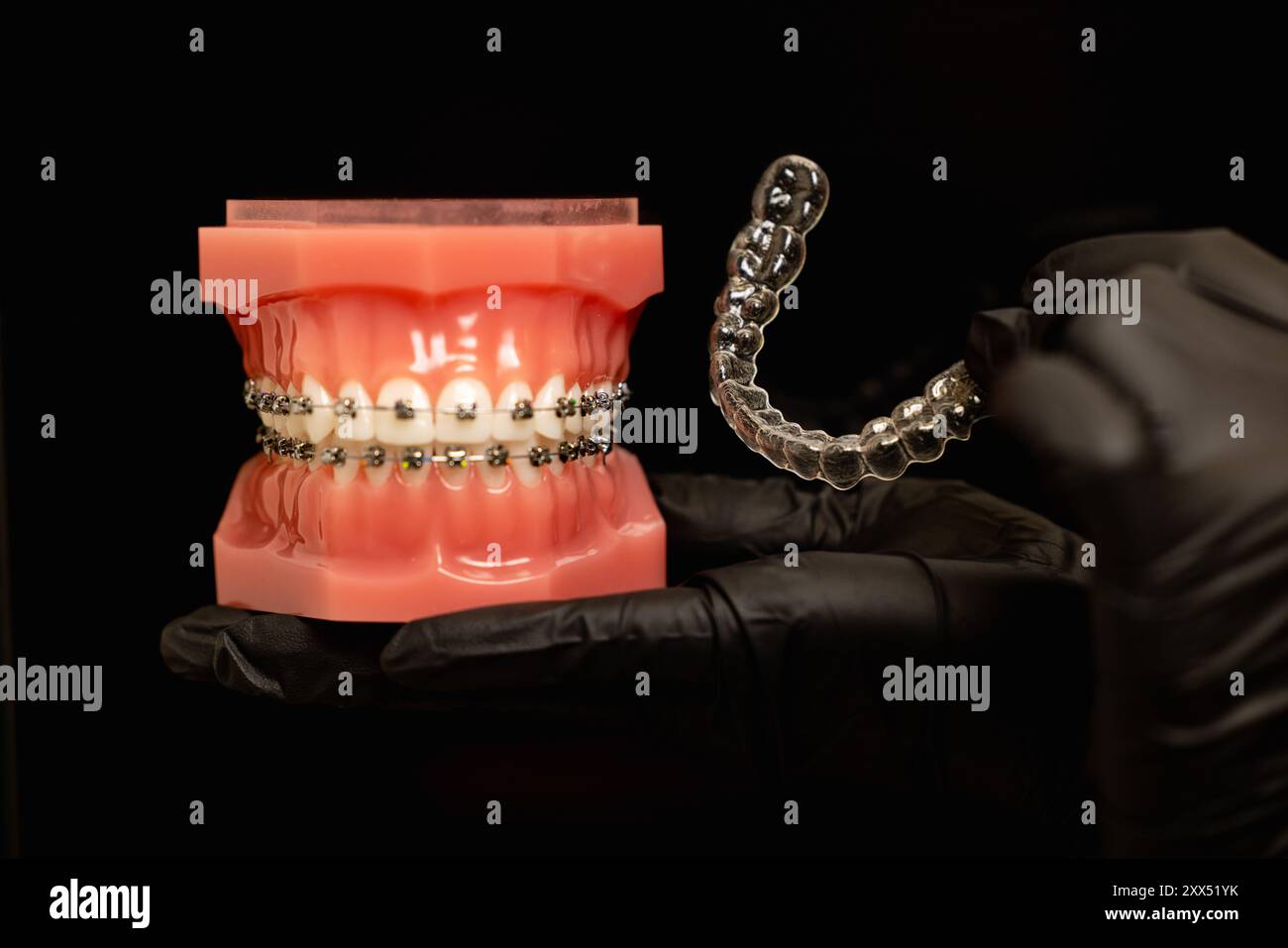 mouth guard and models of teeth with braces on teeth on a jaw Stock ...