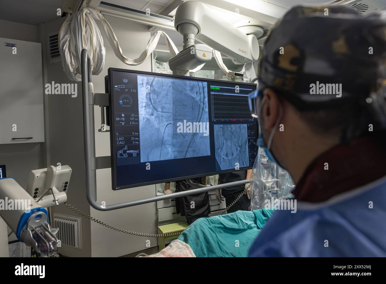 Denizli Turkey-28 February 2024; Doctors conduct a diagnostic operation ...