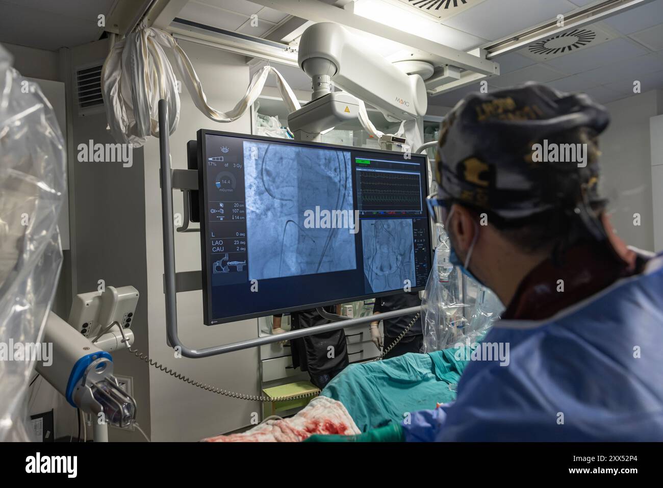 Denizli Turkey-28 February 2024; Doctors conduct a diagnostic operation ...