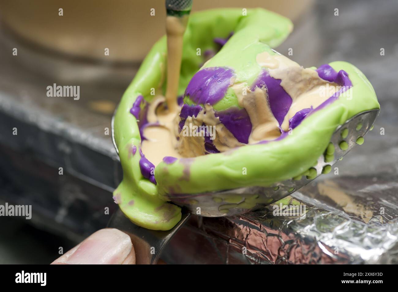 Model of the upper jaw is cast Stock Photo - Alamy