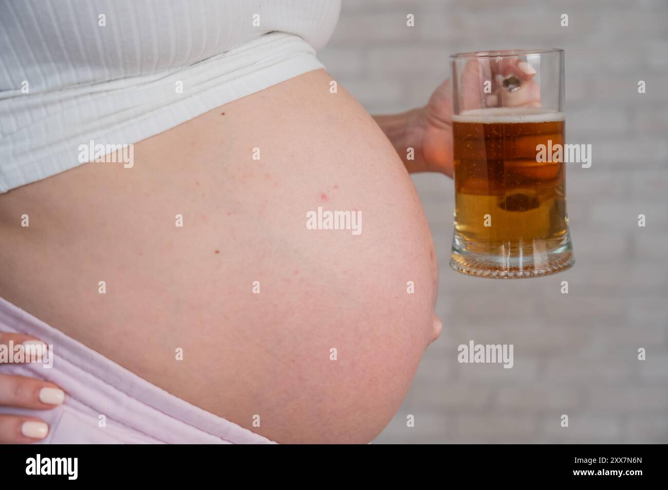 Faceless pregnant woman with rash on stomach holding glass of beer ...