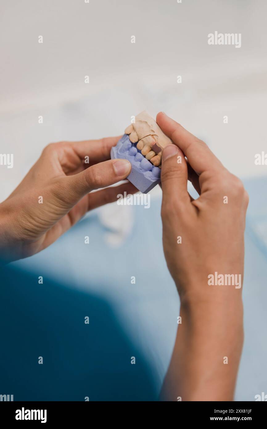 Hands of a dentist fitting a 3d denture mold Stock Photo - Alamy