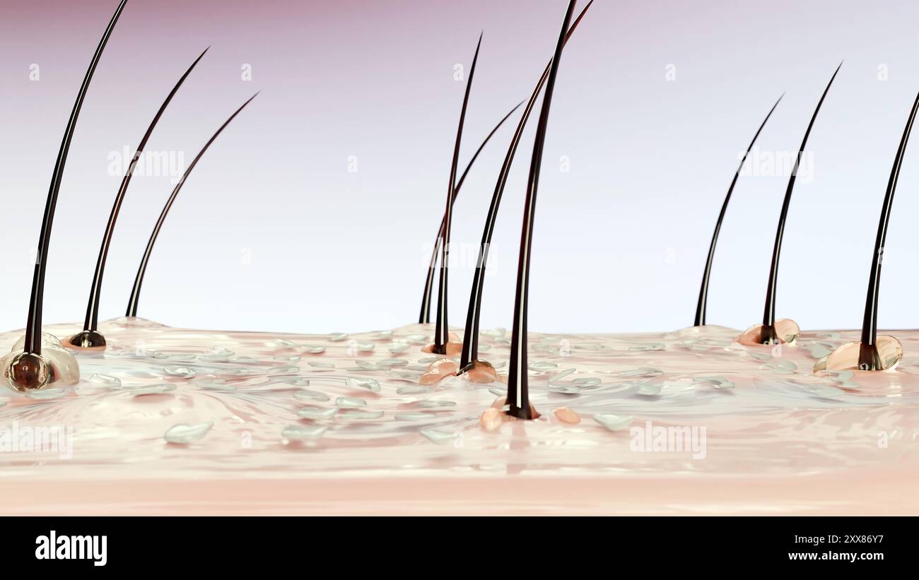 Treatment against Dandruff, Serum nourish, Dermatitis occur, hair care ...