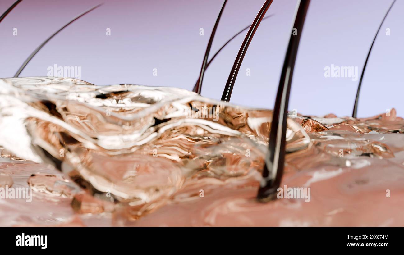 Treatment against Dandruff, Serum nourish, Dermatitis occur, hair care ...