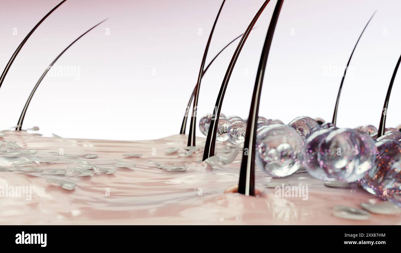 Treatment against Dandruff, Serum nourish, Dermatitis occur, hair care ...