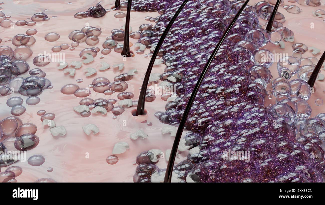 Treatment against Dandruff, Serum nourish, Dermatitis occur, hair care ...