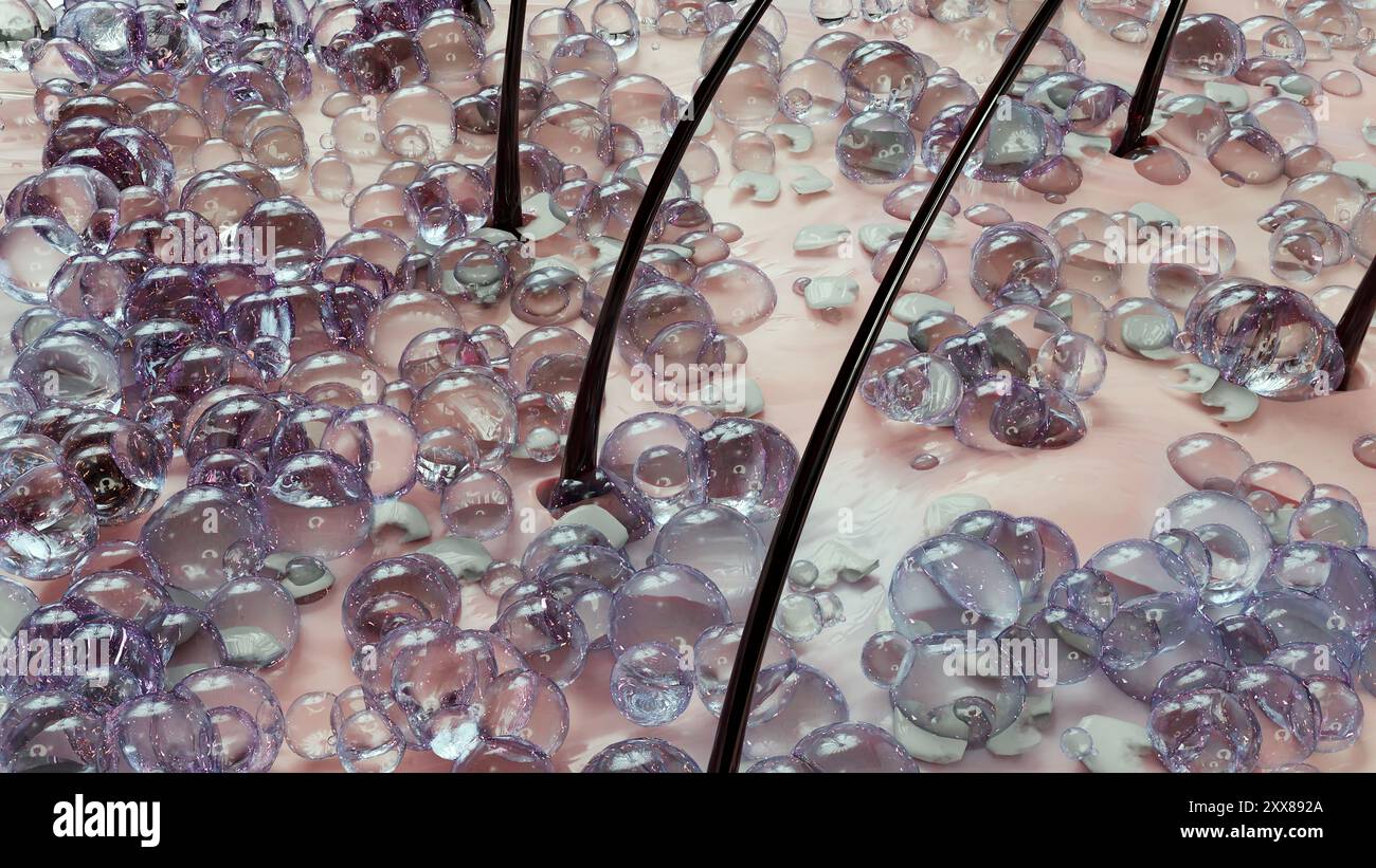 Treatment against Dandruff, Serum nourish, Dermatitis occur, hair care ...