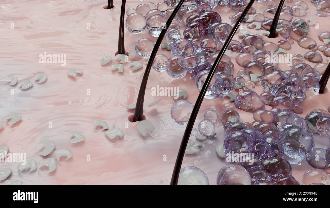 Treatment against Dandruff, Serum nourish, Dermatitis occur, hair care ...