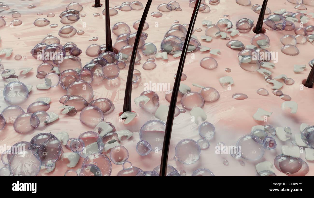 Treatment against Dandruff, Serum nourish, Dermatitis occur, hair care ...