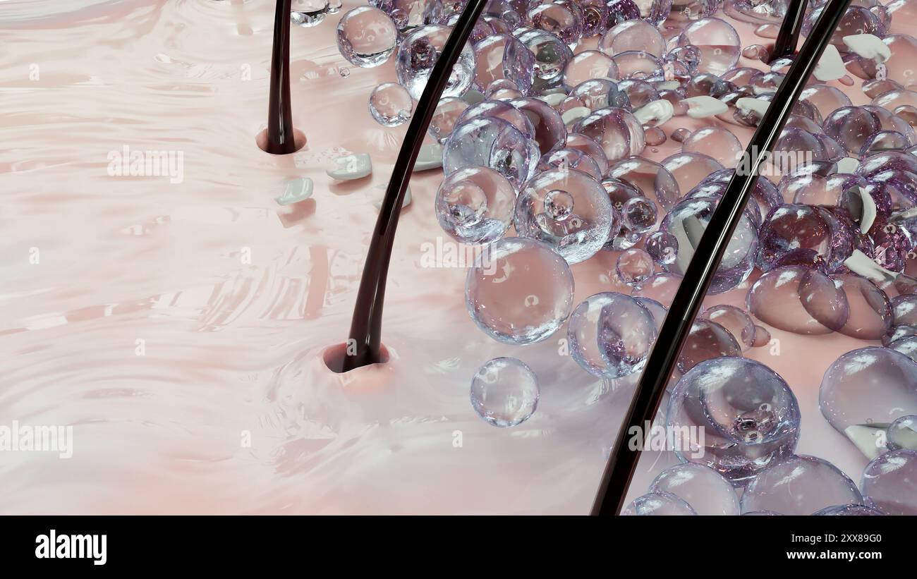 Treatment against Dandruff, Serum nourish, Dermatitis occur, hair care ...