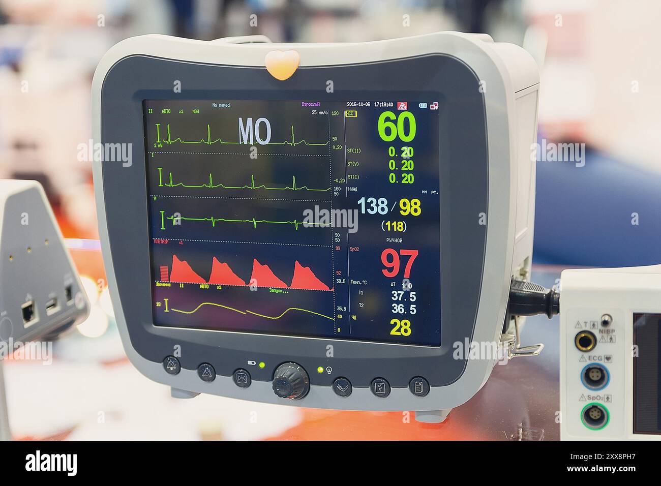 Heart rate monitor in a hospital theater. Medical device for monitoring vital signs in the ...