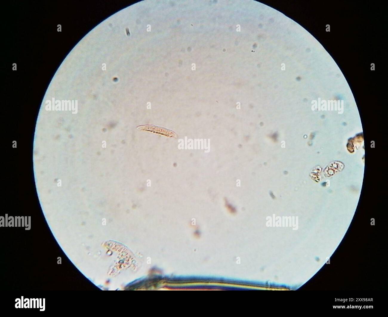 (Capronia pilosella) Fungi Stock Photo - Alamy