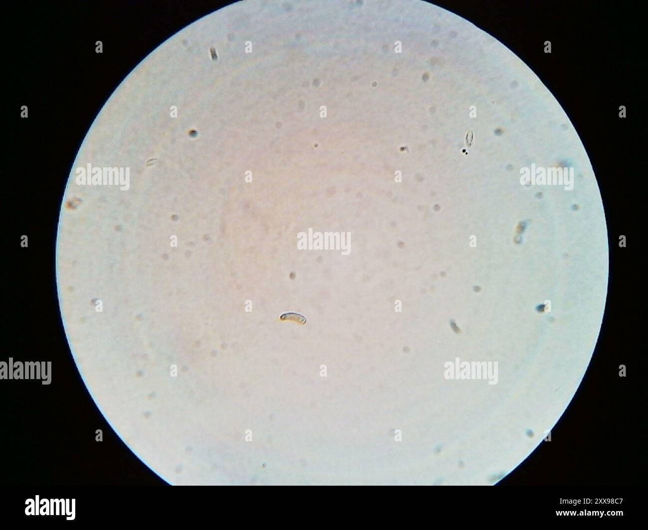 (Capronia pilosella) Fungi Stock Photo - Alamy