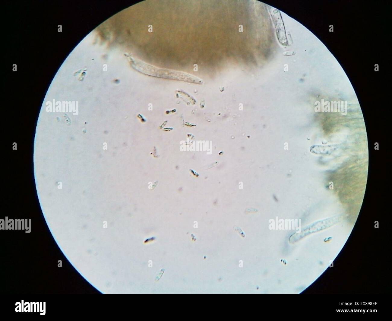 (Capronia pilosella) Fungi Stock Photo - Alamy