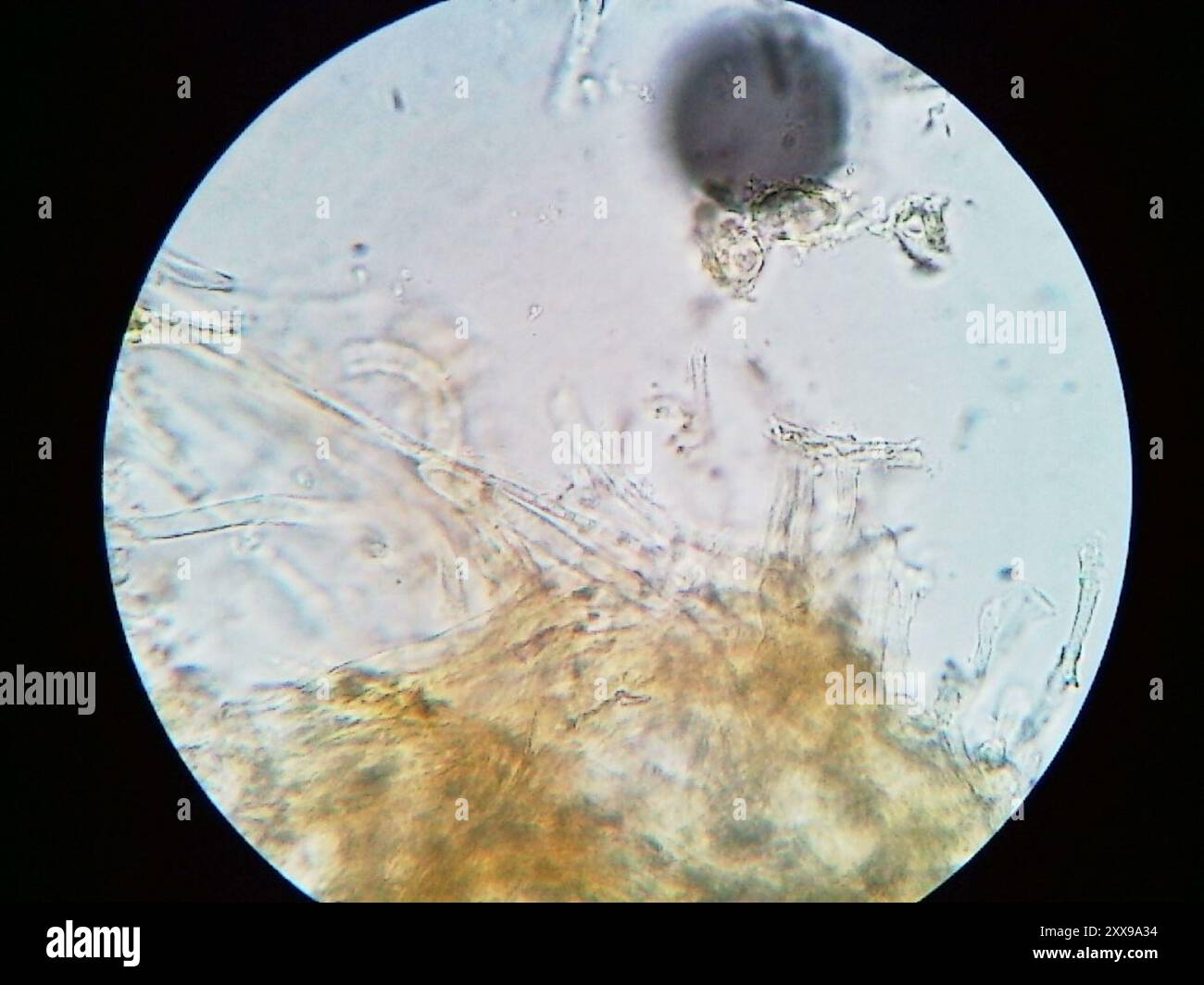 (Capronia pilosella) Fungi Stock Photo - Alamy