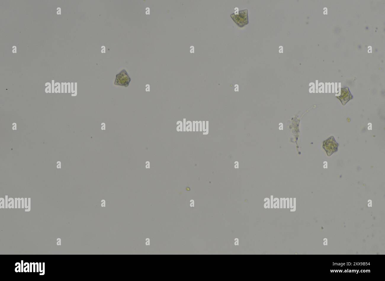 Tumid Notchwort (Lophozia ventricosa) Plantae Stock Photo - Alamy