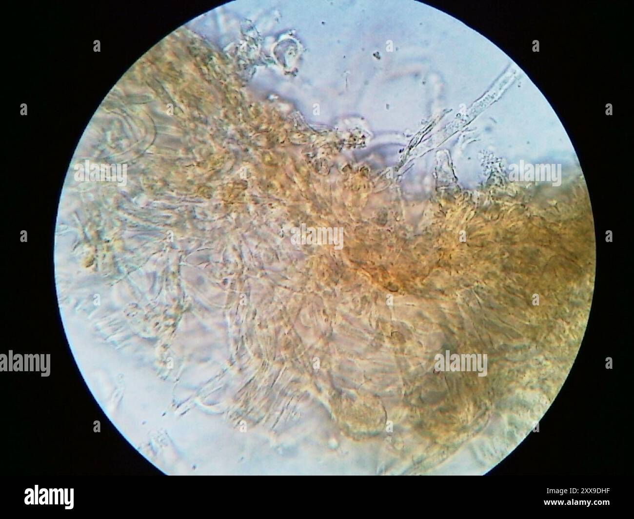 (Capronia pilosella) Fungi Stock Photo - Alamy