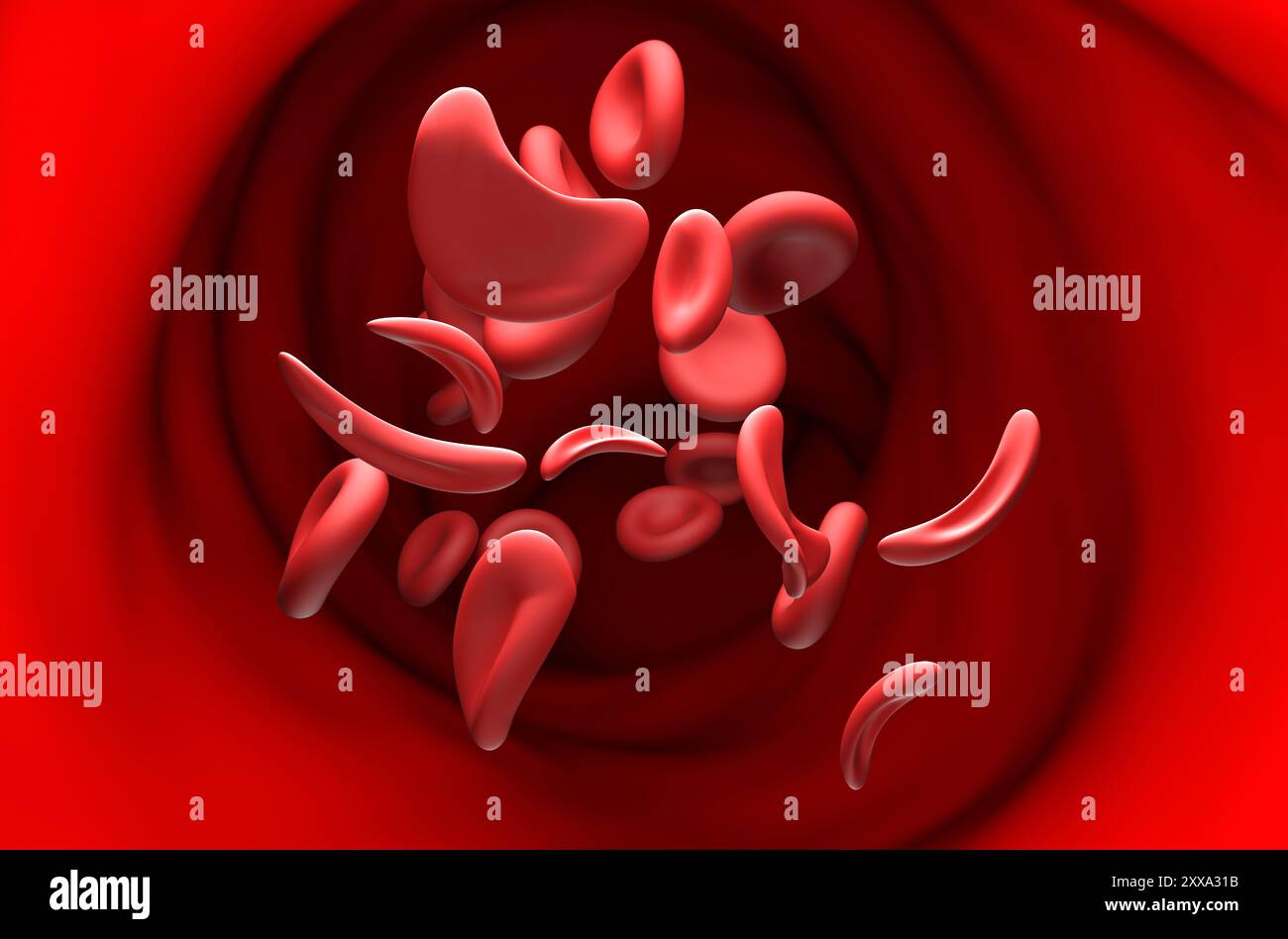 Sickle cell anaemia - section view 3d illustration Stock Photo - Alamy
