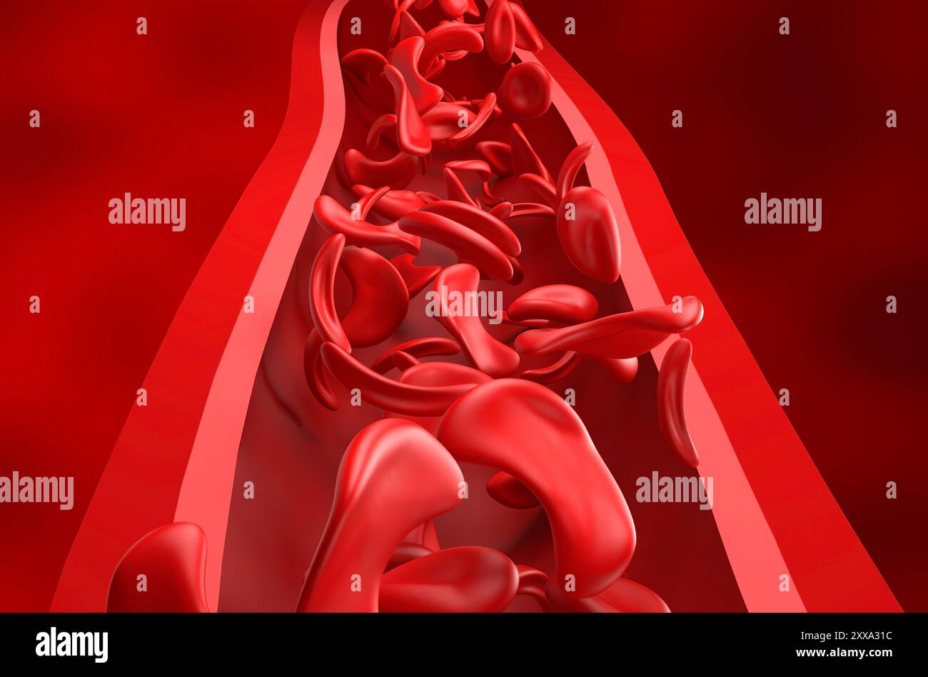 Sickle cell anaemia - front view 3d illustration Stock Photo - Alamy