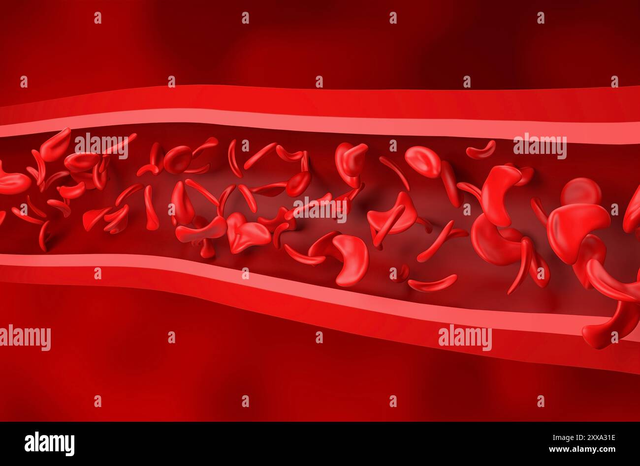 Sickle cell anaemia - isometric view 3d illustration Stock Photo - Alamy