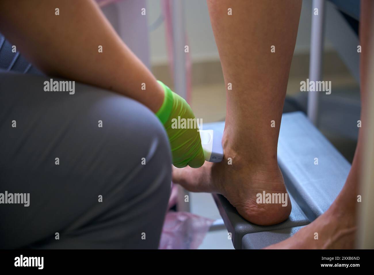 Phlebologist conducts an ultrasound examination of vessels of patients ...