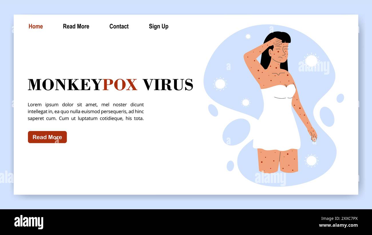 Monkeypox outbreak concept banner. Infected girl from monkey flat ...