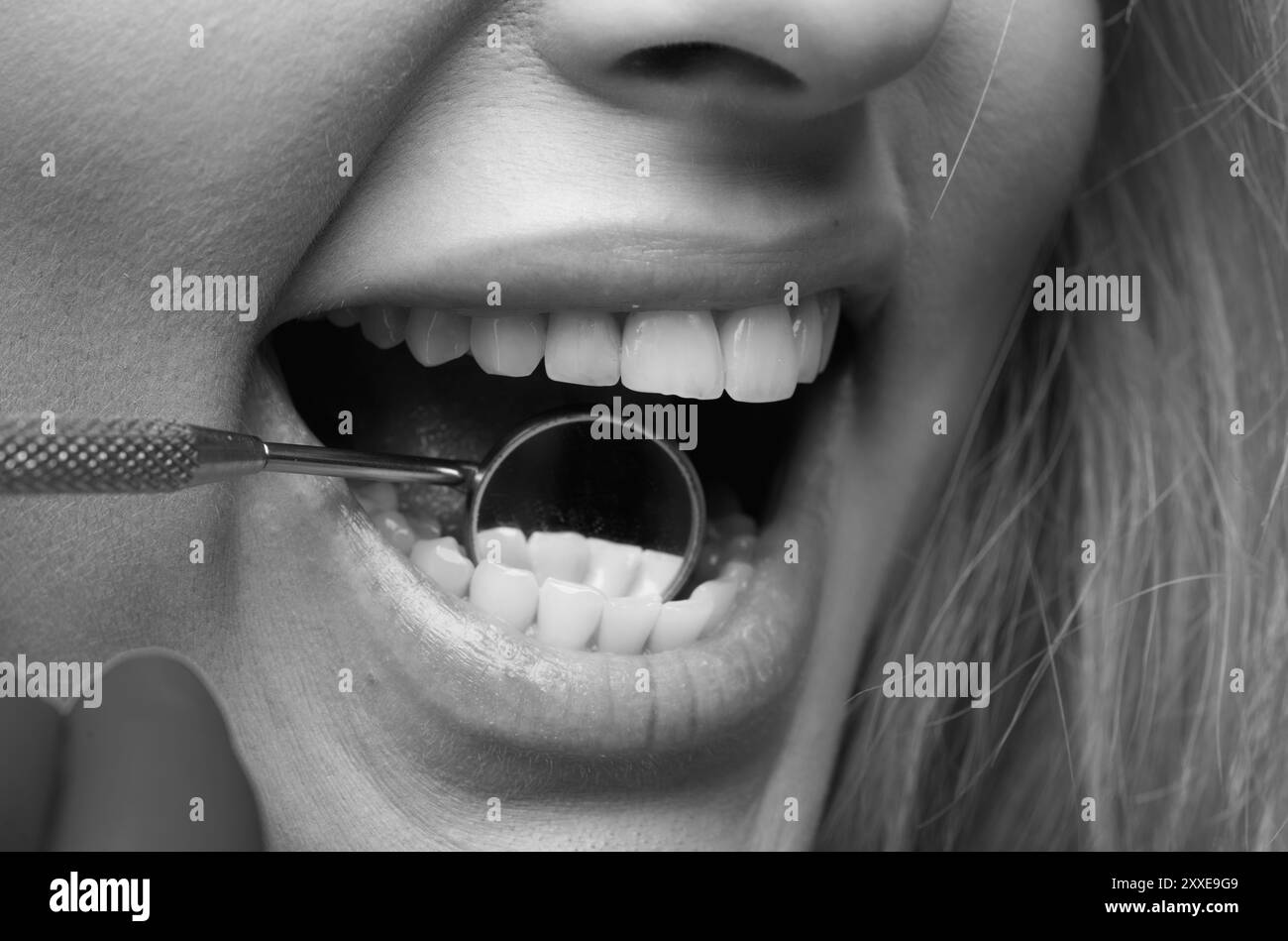 Examination of teeth with dental mirror. Dental and oral hygiene ...