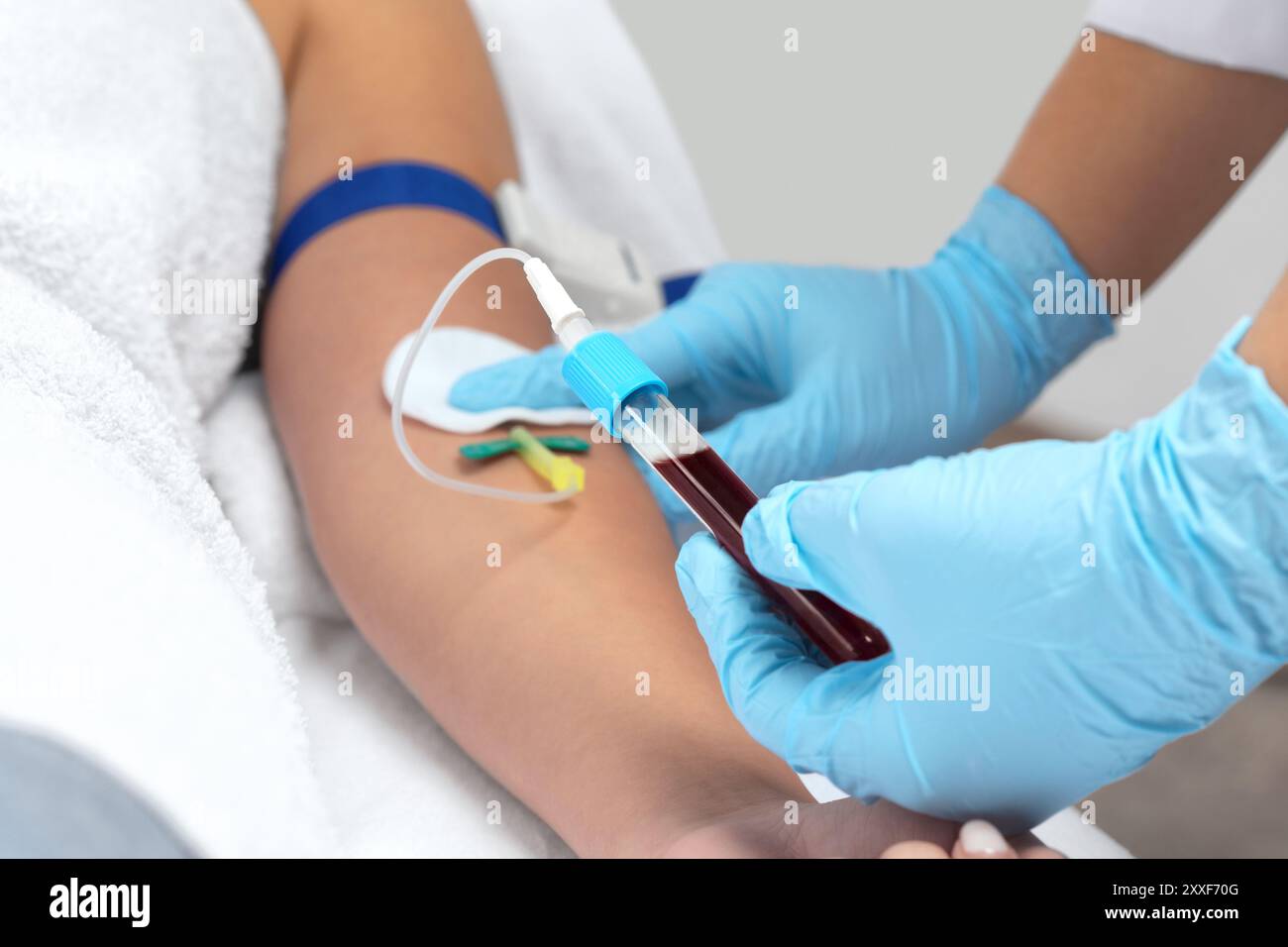 Cosmetologist does prp therapy on the face of a beautiful woman in a ...