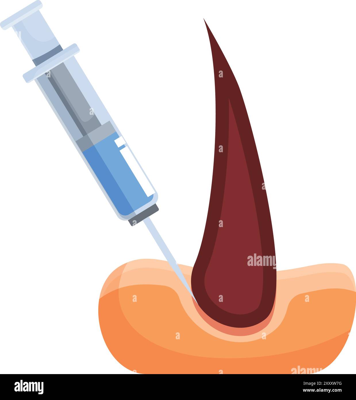 Illustration of a syringe injecting serum into skin for hair ...
