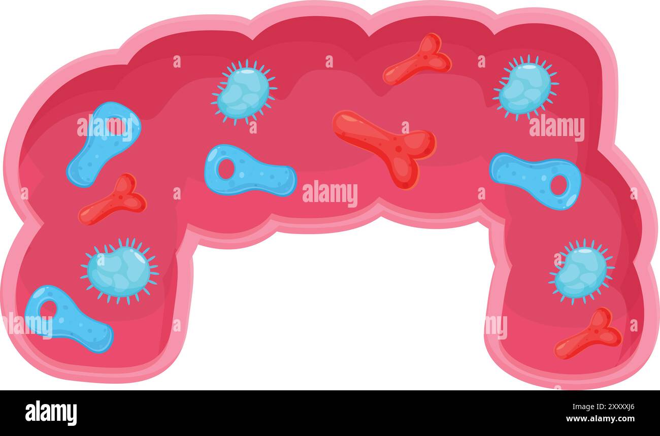 Cartoon bacteria and viruses inside human intestine causing gut ...