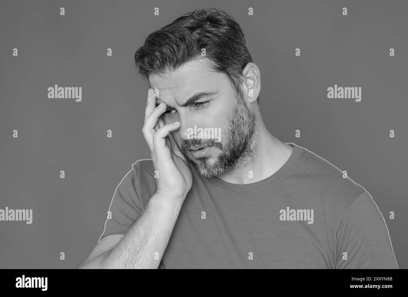 Man suffering from headache. Tired, headache and eye strain. Man with ...