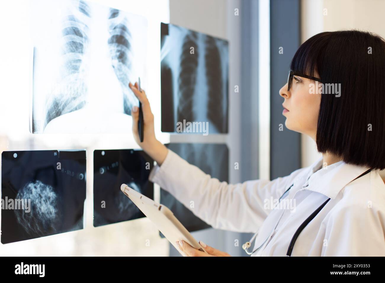 Female doctor examining chest x-rays in hospital Stock Photo - Alamy