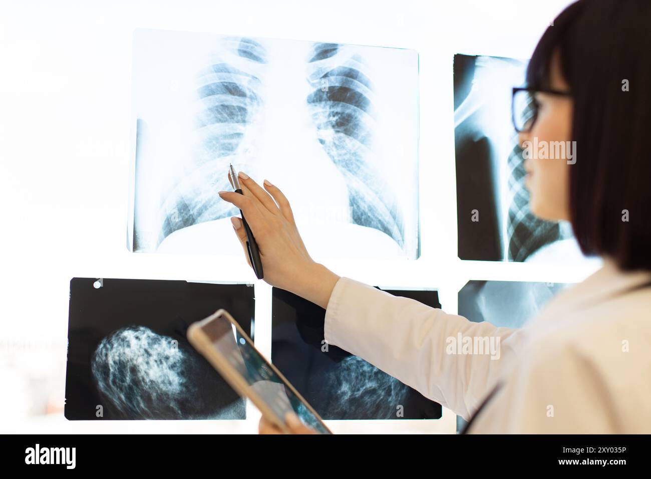 Doctor examining chest X-rays with digital tablet Stock Photo - Alamy