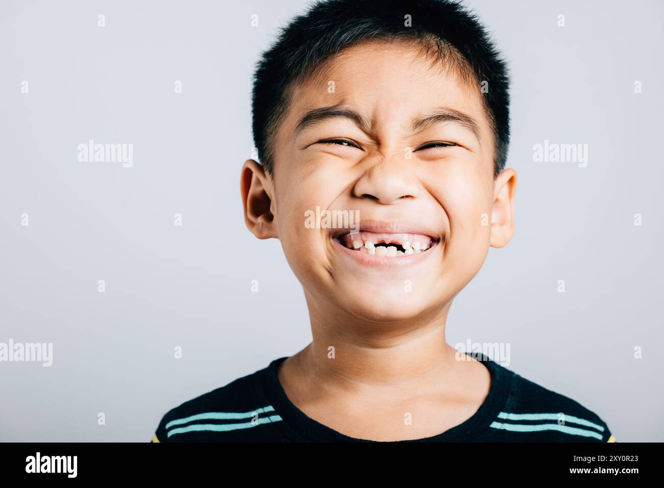 Smiling kid gap in upper teeth showing lost tooth. Child isolated ...