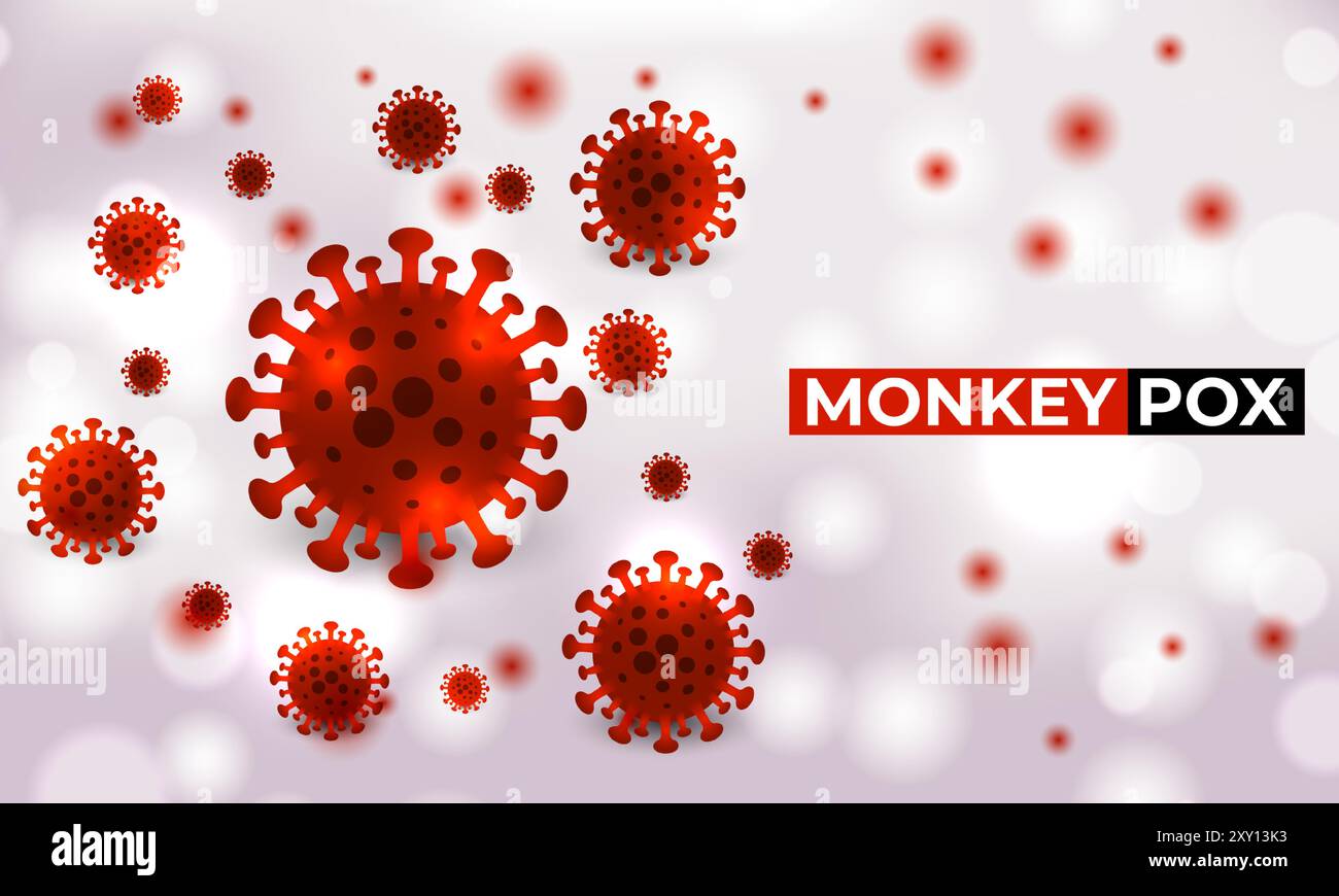 Monkeypox virus cells outbreak medical banner. Monkeypox virus cells on ...