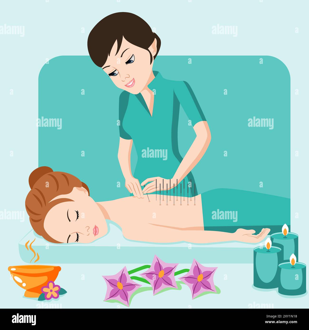 Needle Acupuncturetreatments By Professional Acupuncturist In Spa