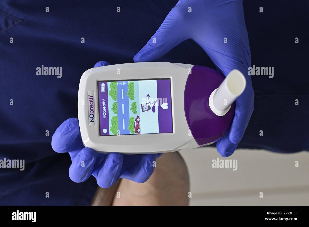 Fractional exhaled nitric oxide monitor. The device measures the levels ...