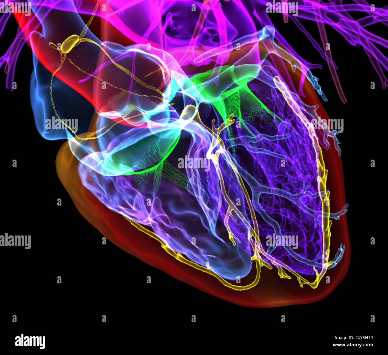 Coloured computed tomography (CT) scan of the human heart, highlighting ...