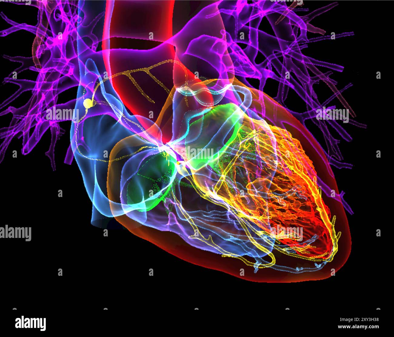 Coloured computed tomography (CT) scan of the human heart, highlighting ...