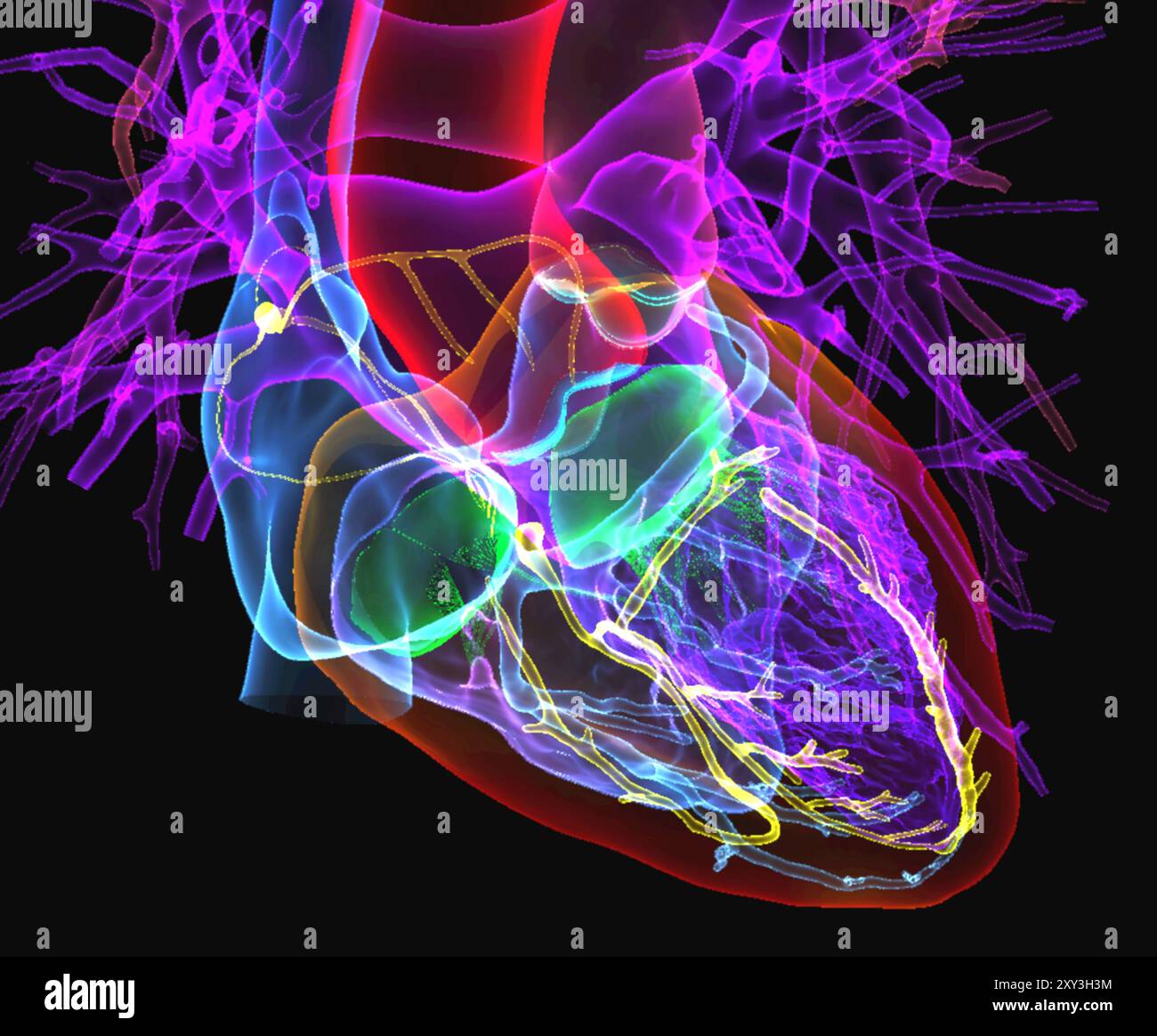 Coloured computed tomography (CT) scan of the human heart, highlighting ...