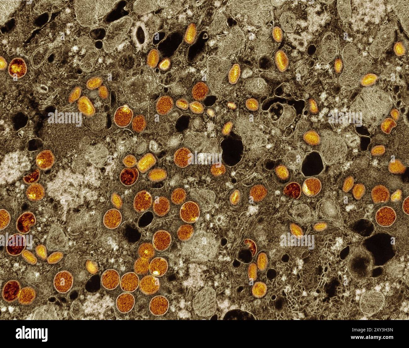 Coloured transmission electron micrograph (TEM) of mpox virus particles ...
