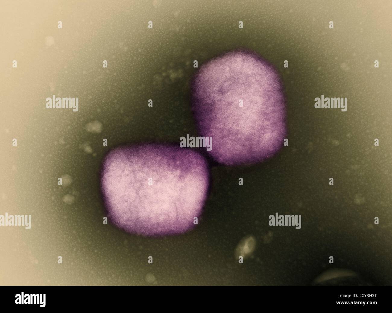 Coloured transmission electron micrograph (TEM) of mpox virus particles ...