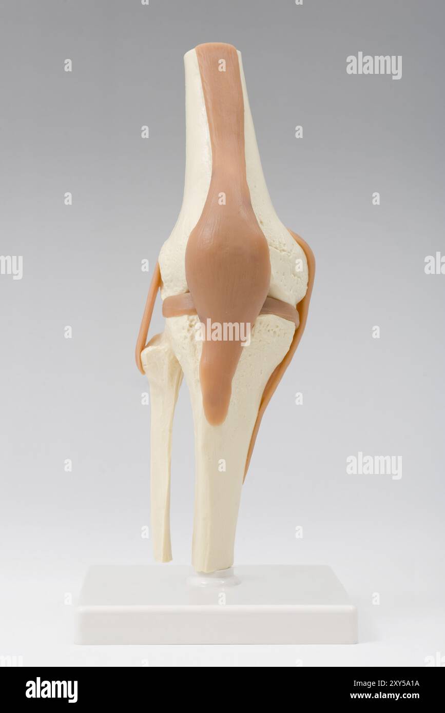 Artificial knee joint Stock Photo - Alamy