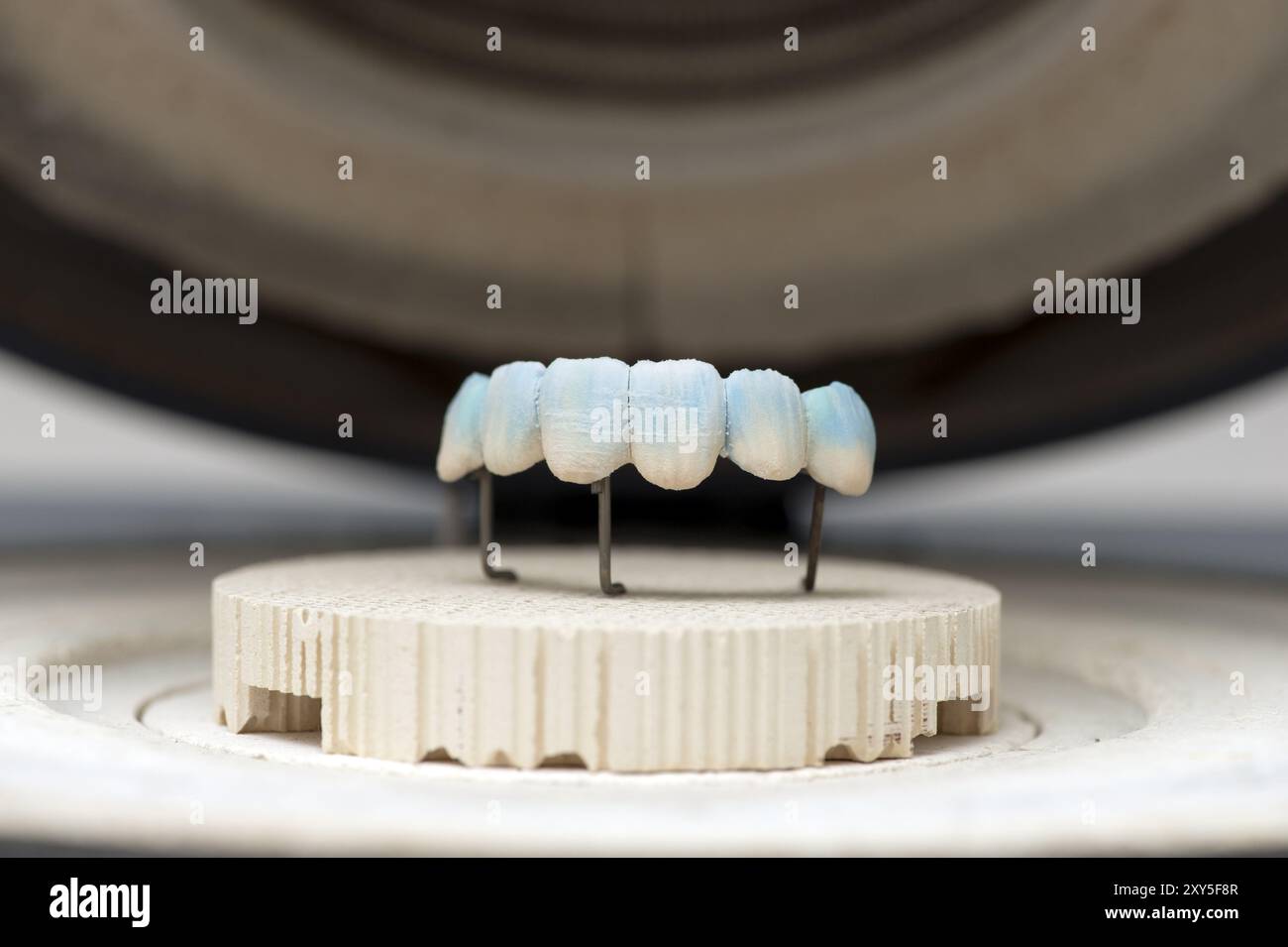 Metal ceramic tooth crowns hi-res stock photography and images - Alamy