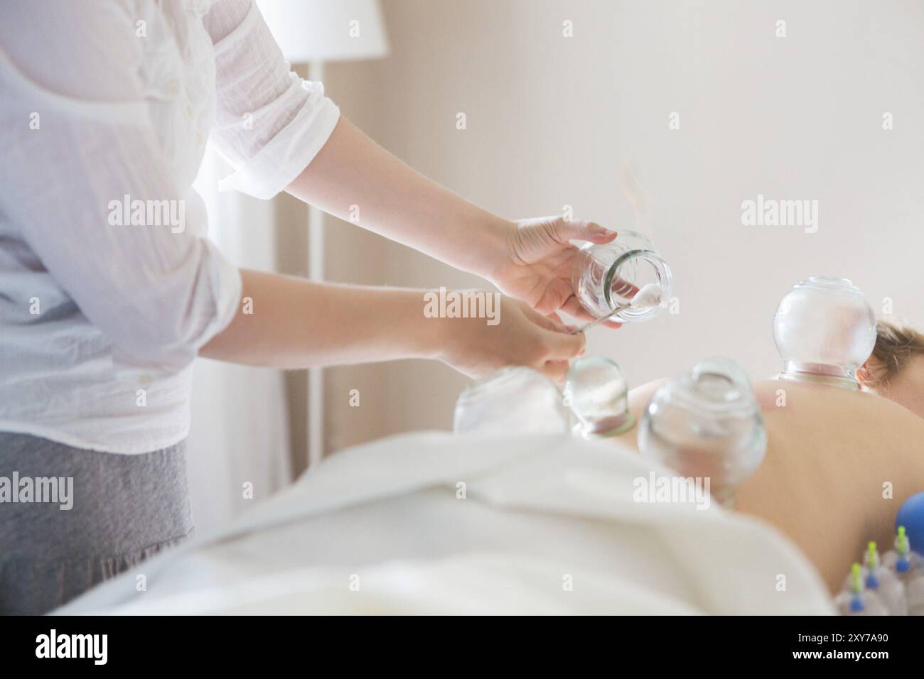 Young woman getting treatment at medical clinic. Fire cupping cups on ...